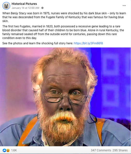 Fact Check: This is NOT Benjy Stacy, Born With Dark Blue Skin -- It's Paul Karason Who Turned ...